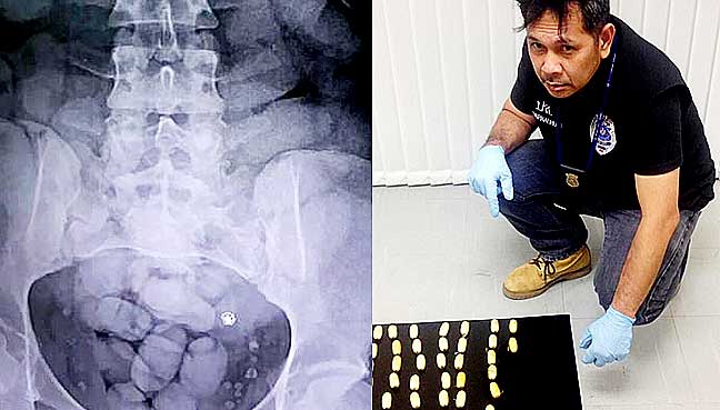 Thailand arrests female Ivorian who swallowed 1kg of cocaine - Ships ...